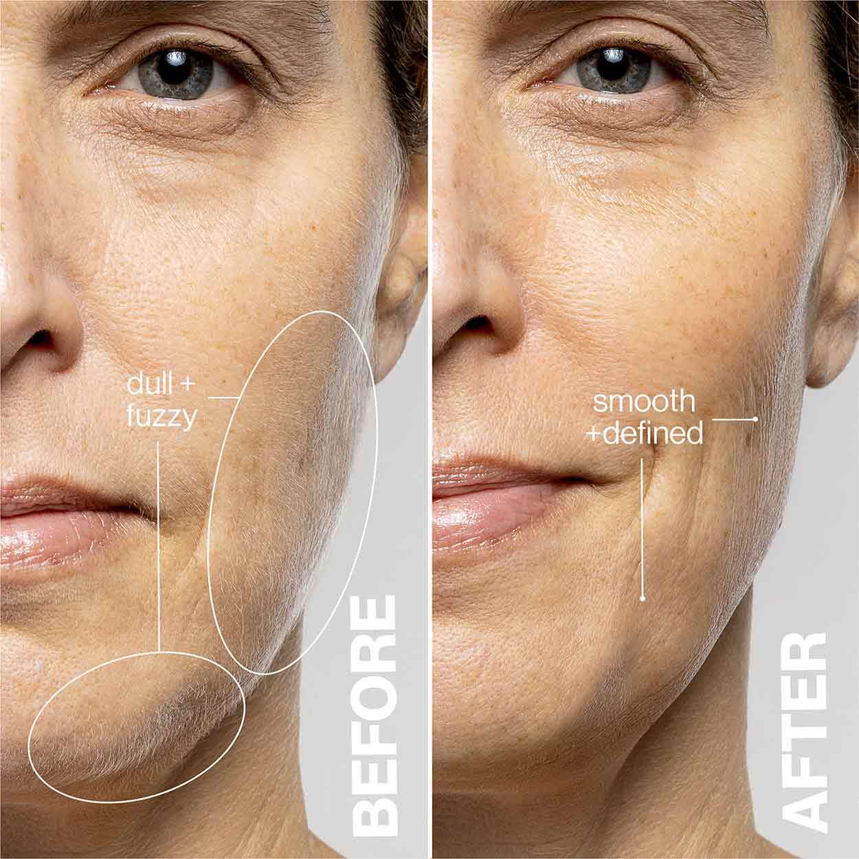 DERMAFLASH DERMAFLASH LUXE+ Advanced Sonic Dermaplaning + Peach Fuzz ...